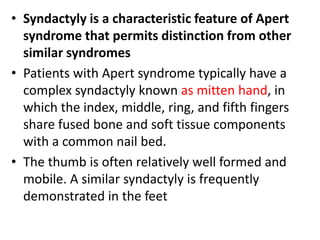Craniosynostosis syndromes.pptx,,,,,,,,,,, | PPTX
