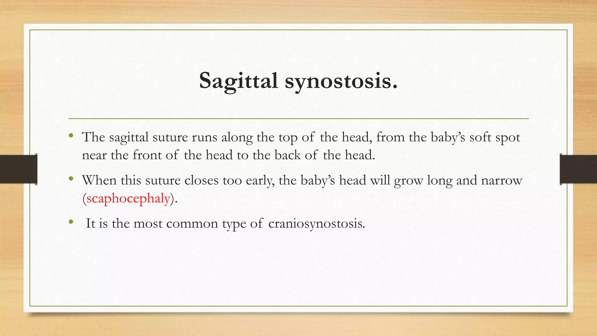 Craniosynotosis | PPTX