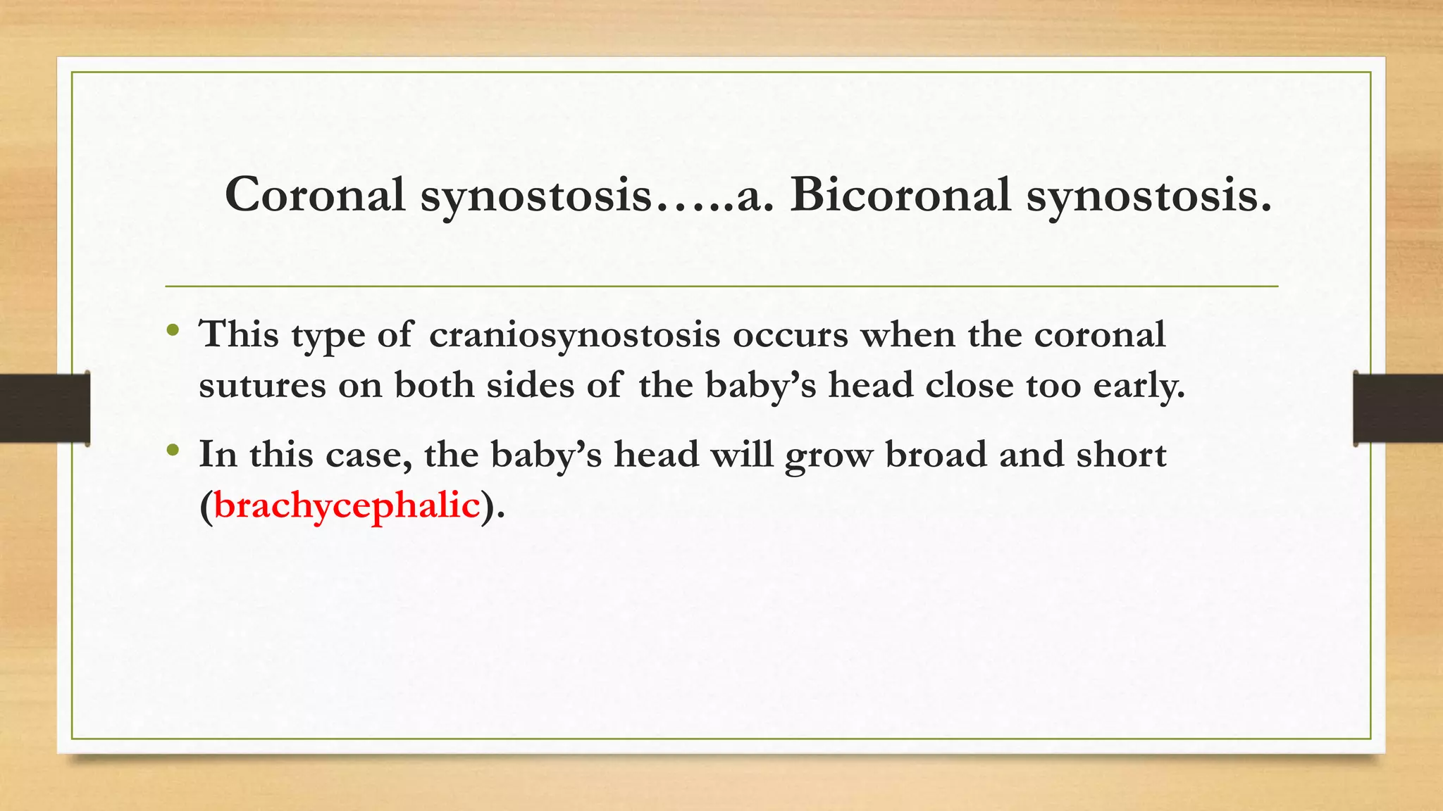 Craniosynotosis | PPTX