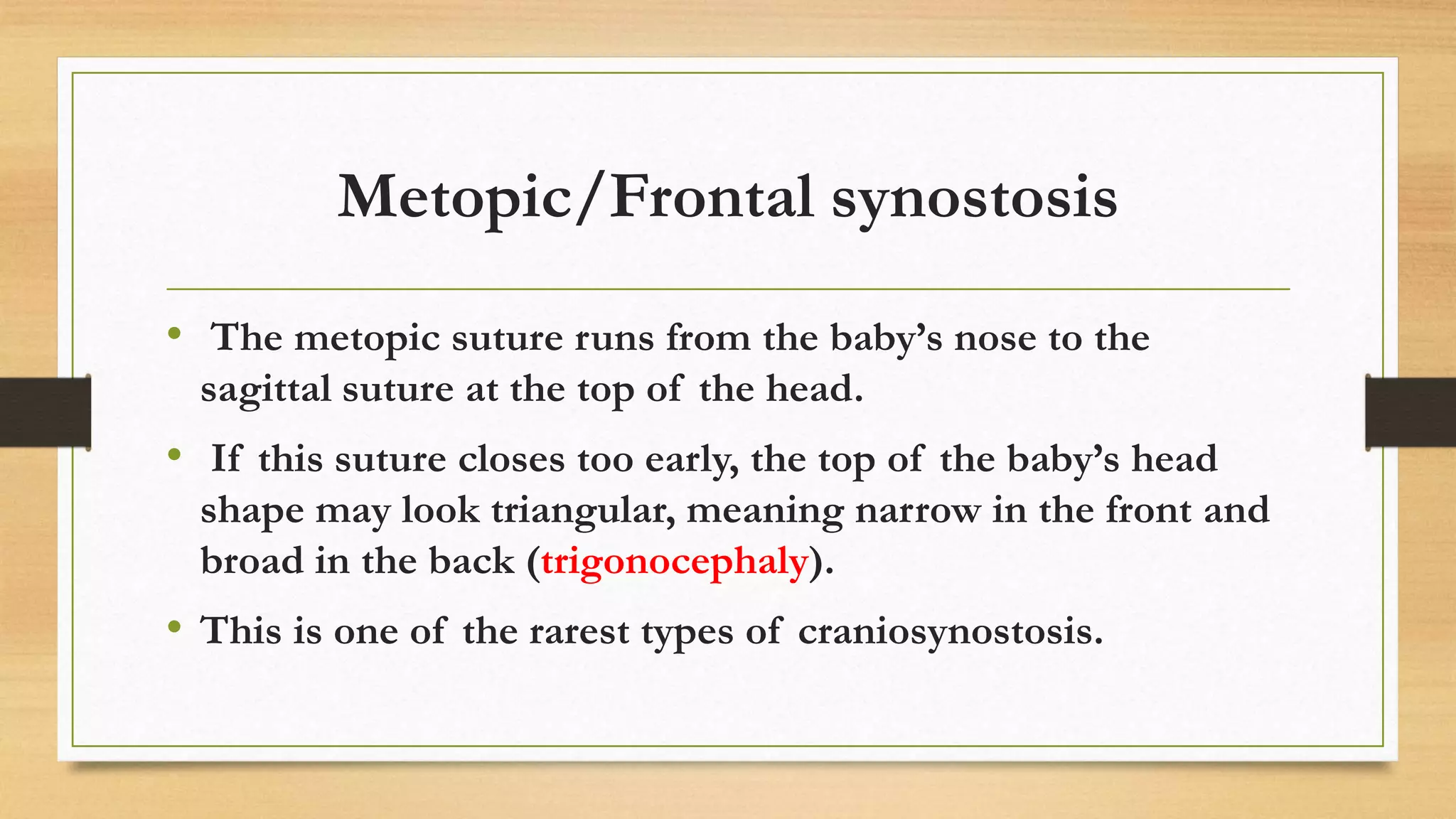 Craniosynotosis | PPTX