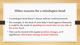 Craniosynotosis | PPTX