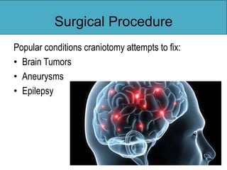 Craniotomy | PPTX