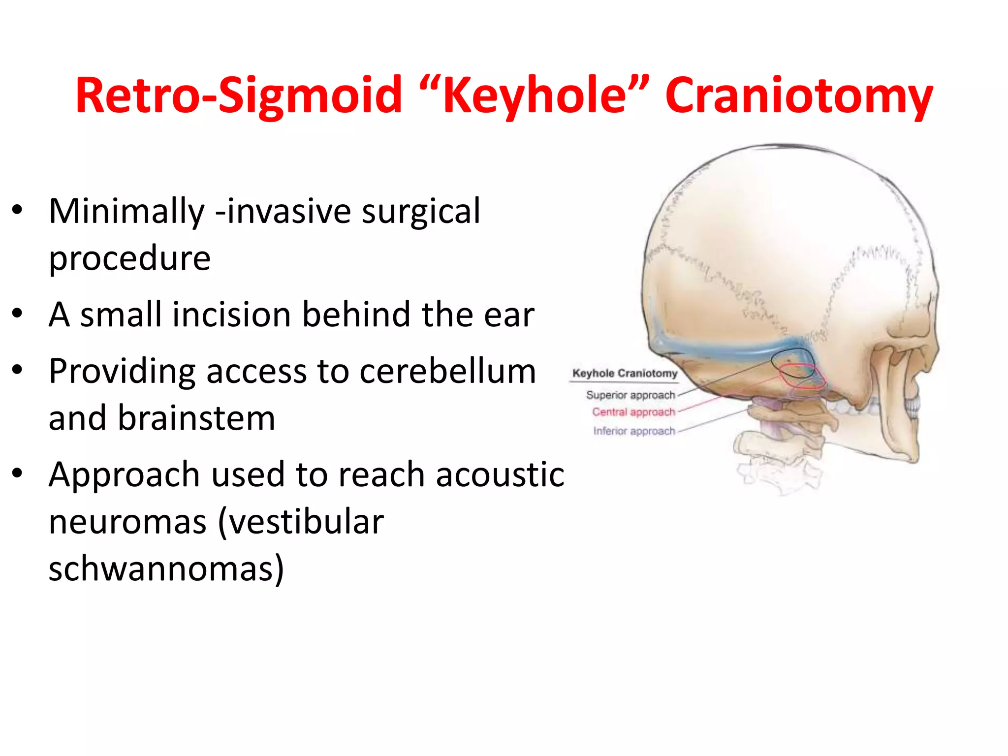 Craniotomy.pptx