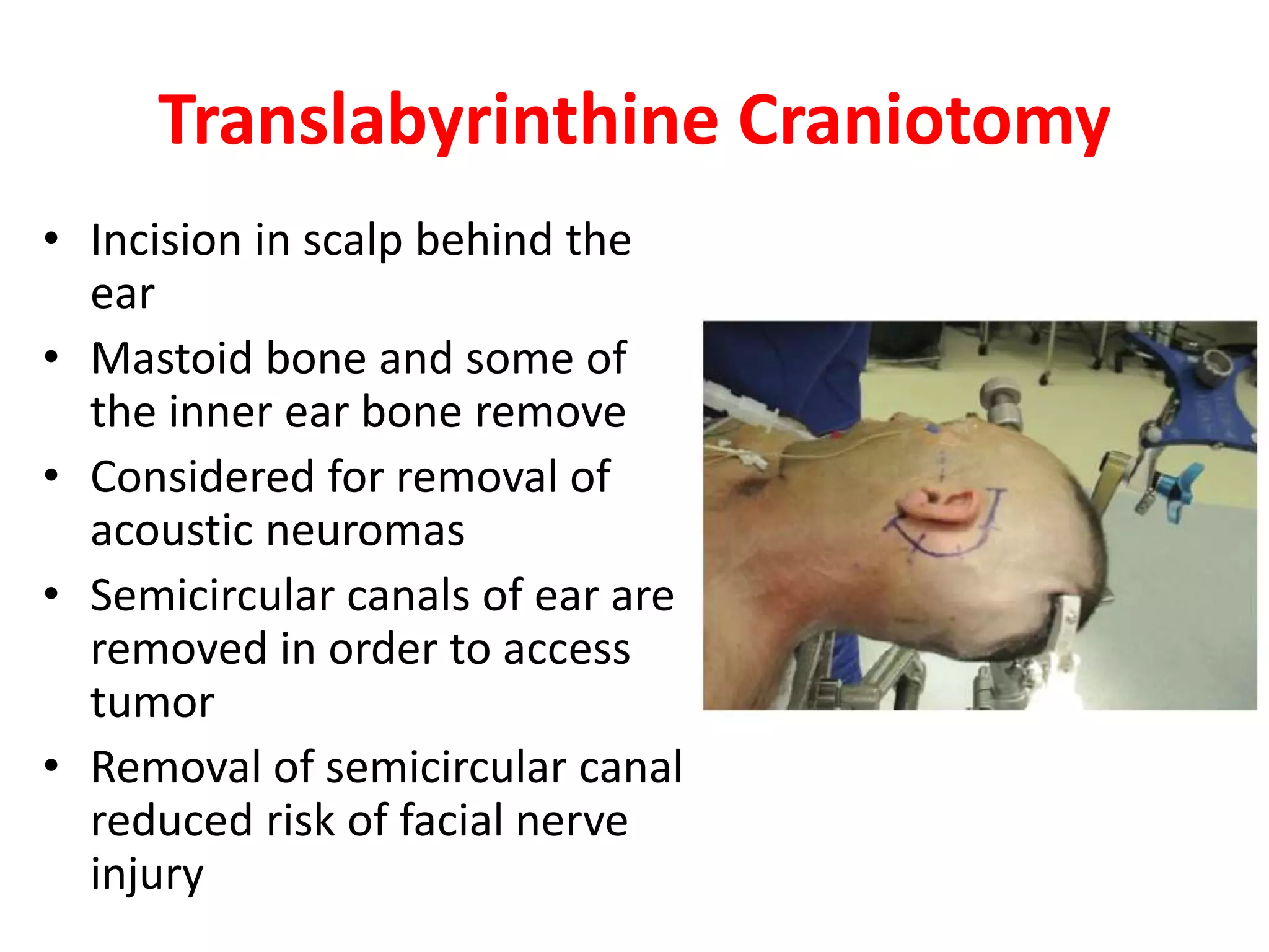 Craniotomy.pptx