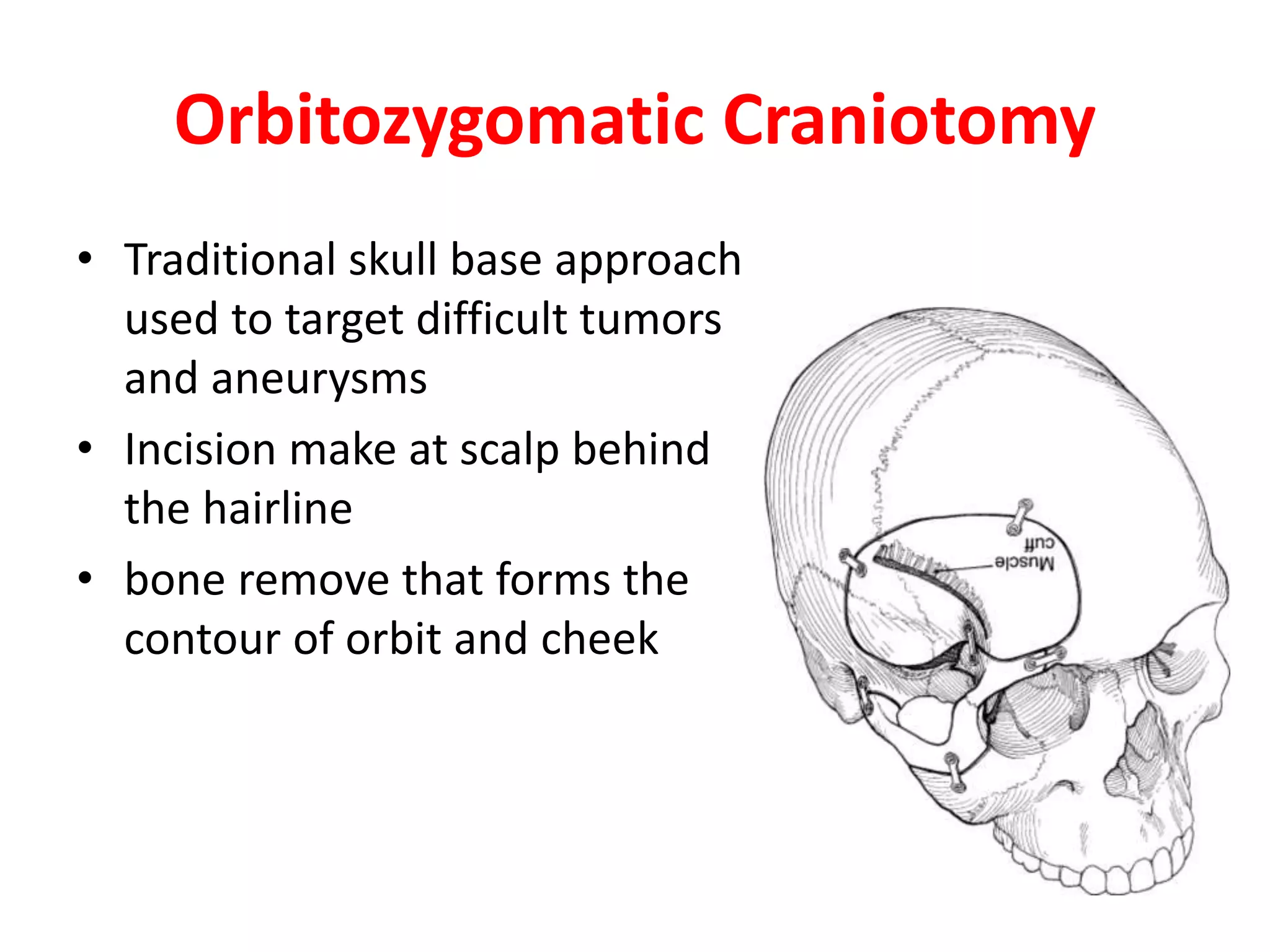 Craniotomy.pptx