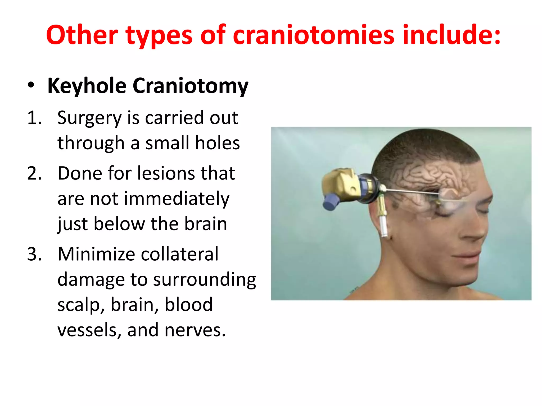 Craniotomy.pptx