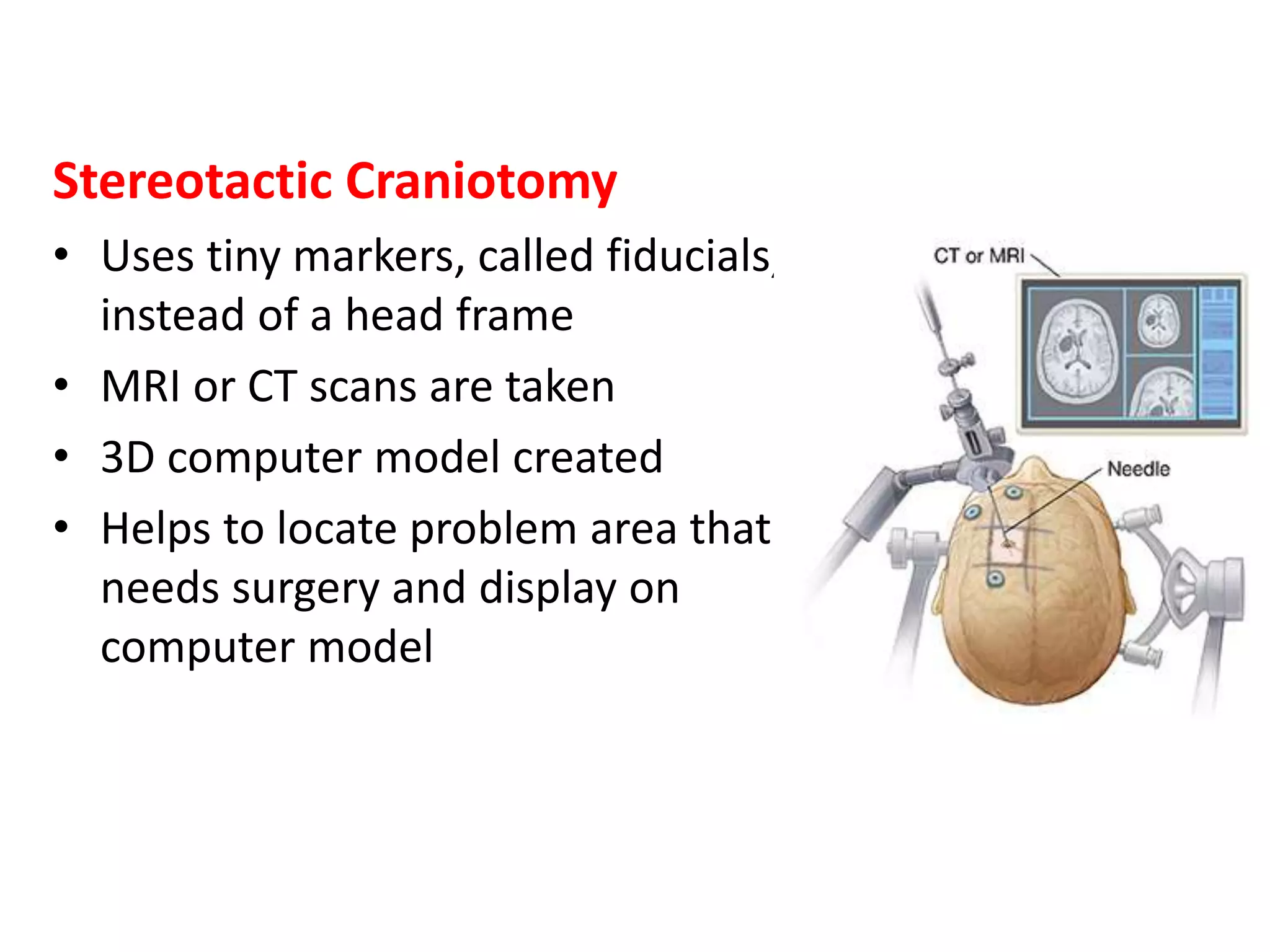 Craniotomy.pptx