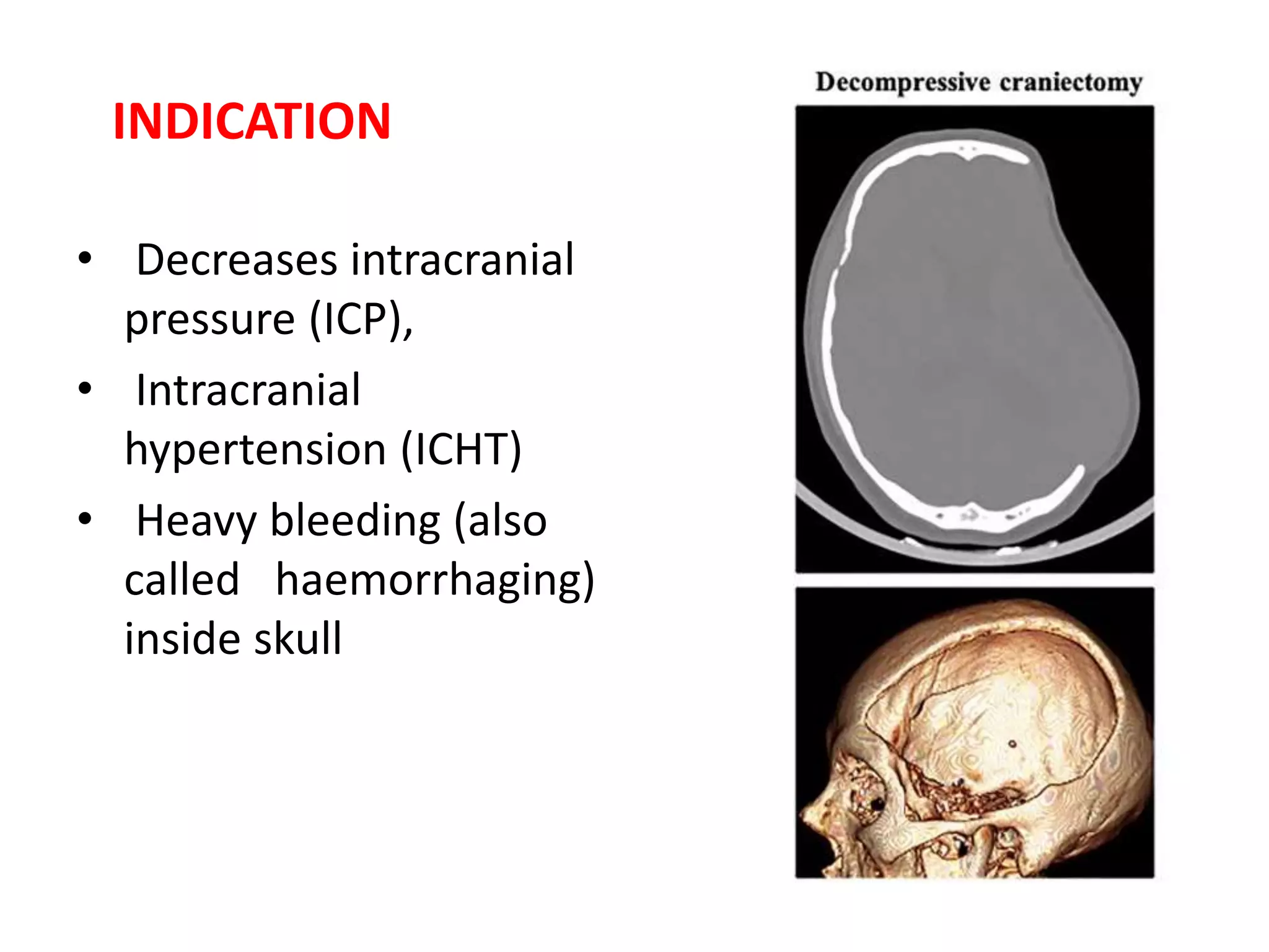 Craniotomy.pptx