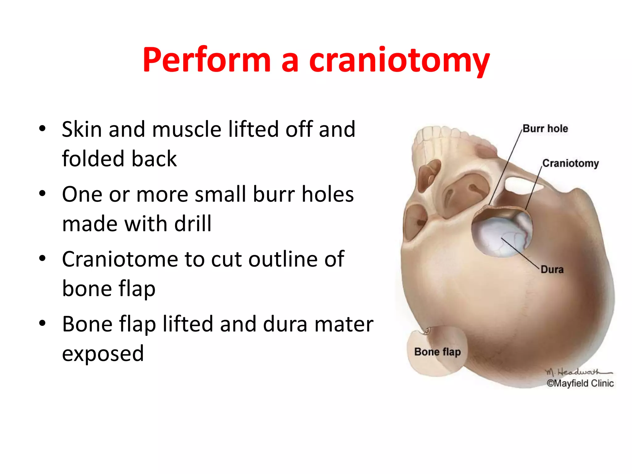Craniotomy.pptx