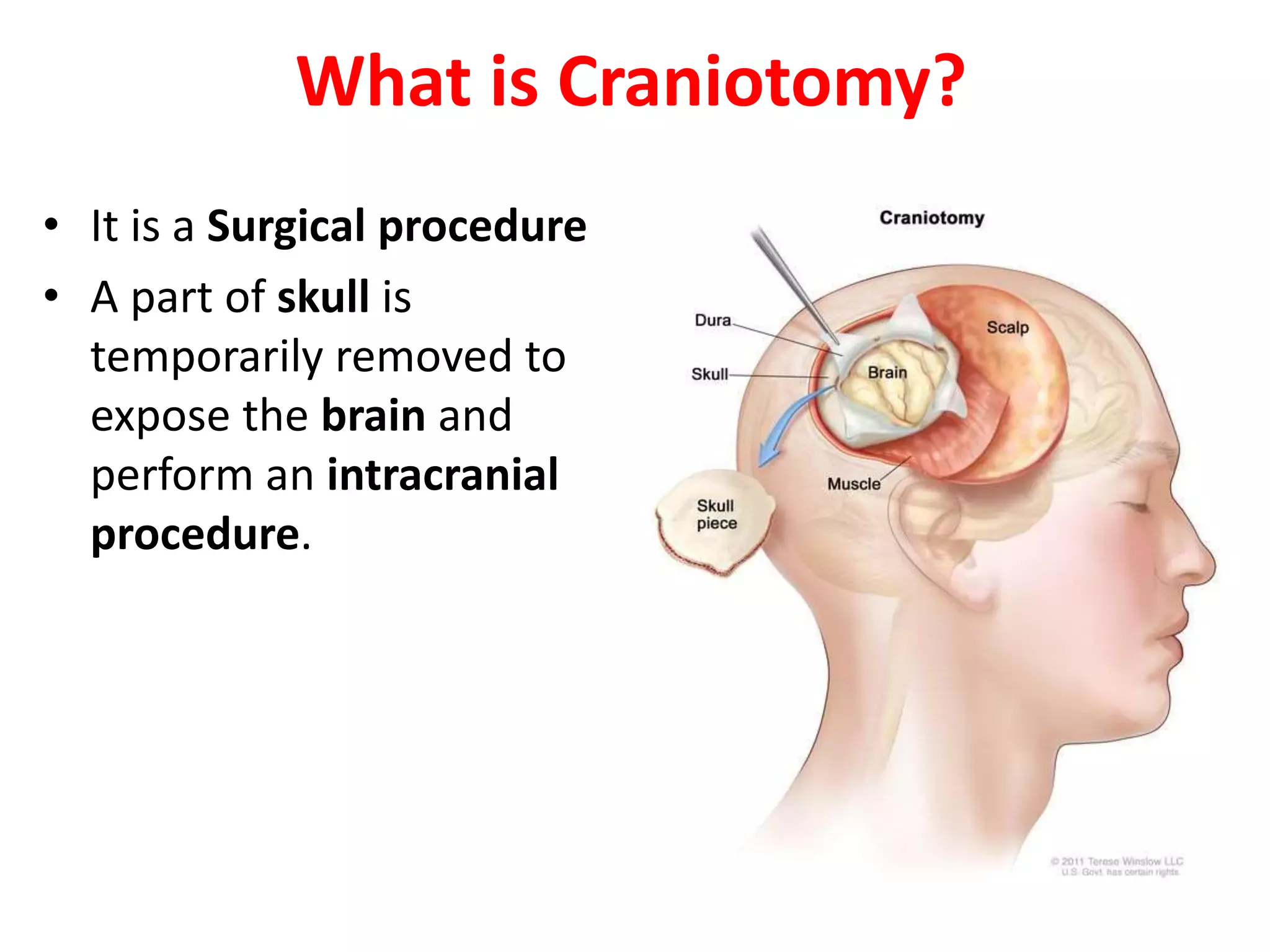 Craniotomy.pptx