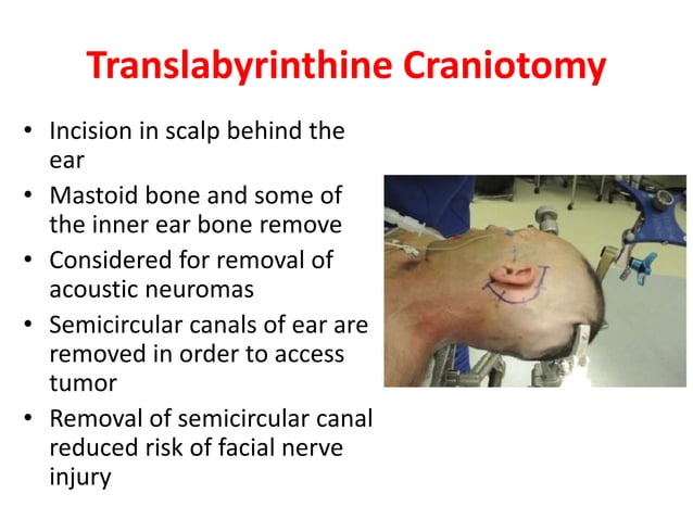 Craniotomy.pptx | Death, Injury, or Military Conflict | Sensitive Topics