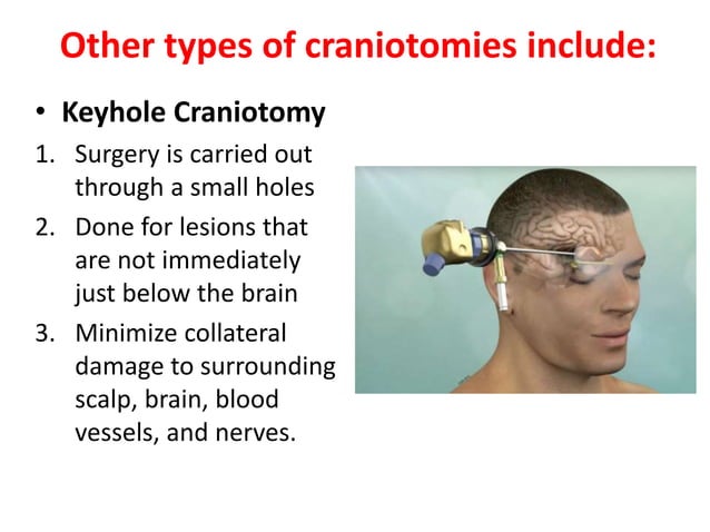 Craniotomy.pptx | Death, Injury, or Military Conflict | Sensitive Topics