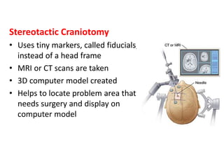 Craniotomy.pptx