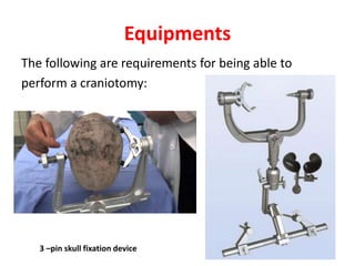 Craniotomy.pptx