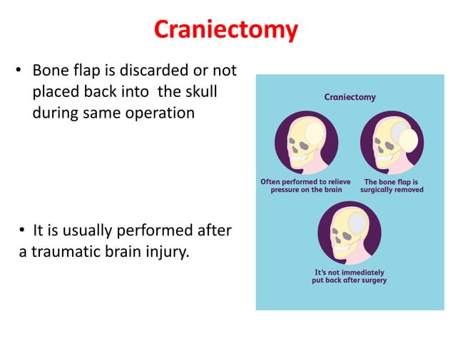 Craniotomypptx