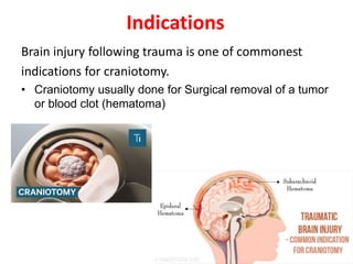Craniotomy.pptx