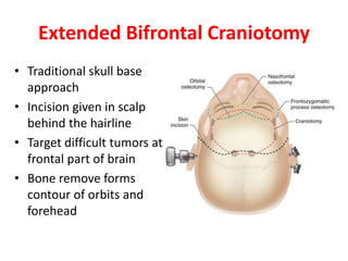 Craniotomy.pptx