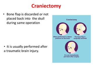 Craniotomy.pptx