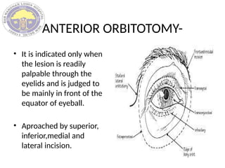 CRANIOTOMY FLAPS ,INCISION AND CLOSURE.pptx
