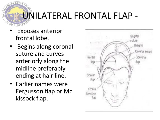 CRANIOTOMY FLAPS ,INCISION AND CLOSURE.pdf