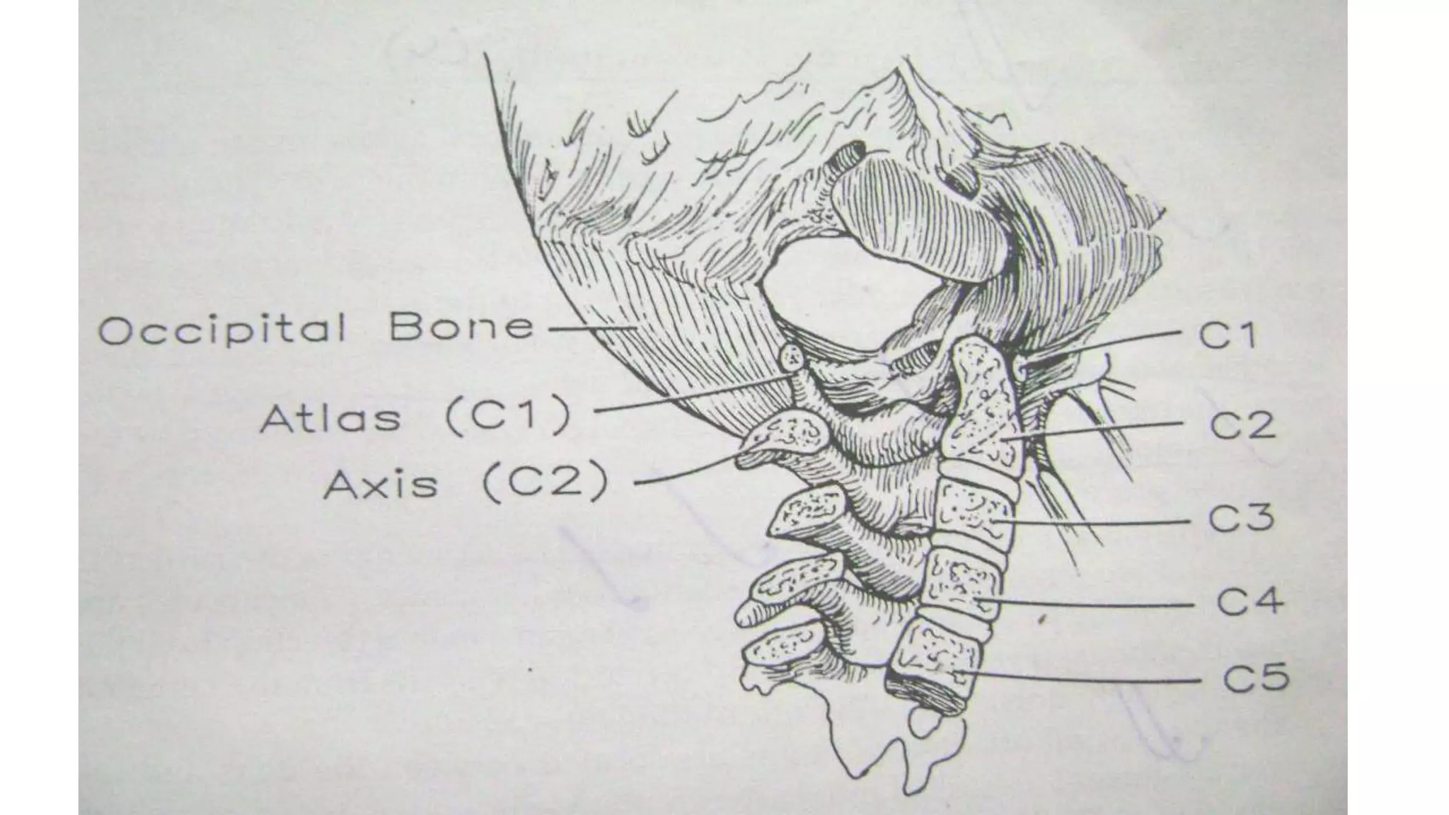 Craniovertebral JUNCTION ANOMALIES | PPTX