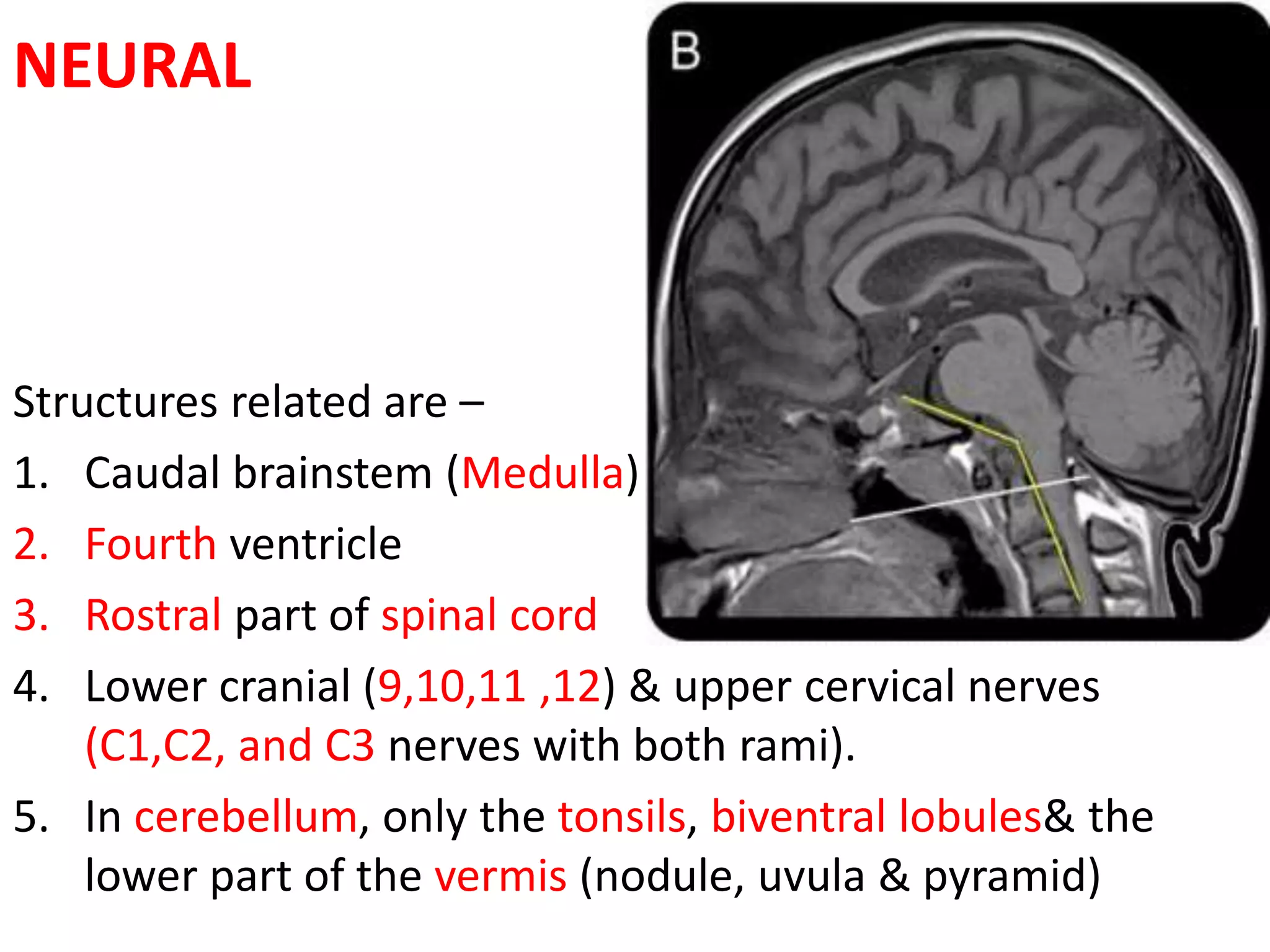 Craniovertebral junction | PPTX