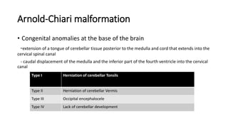 Craniovertebral junction anomaly | PPTX