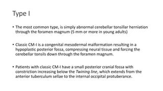 Craniovertebral junction anomaly | PPTX