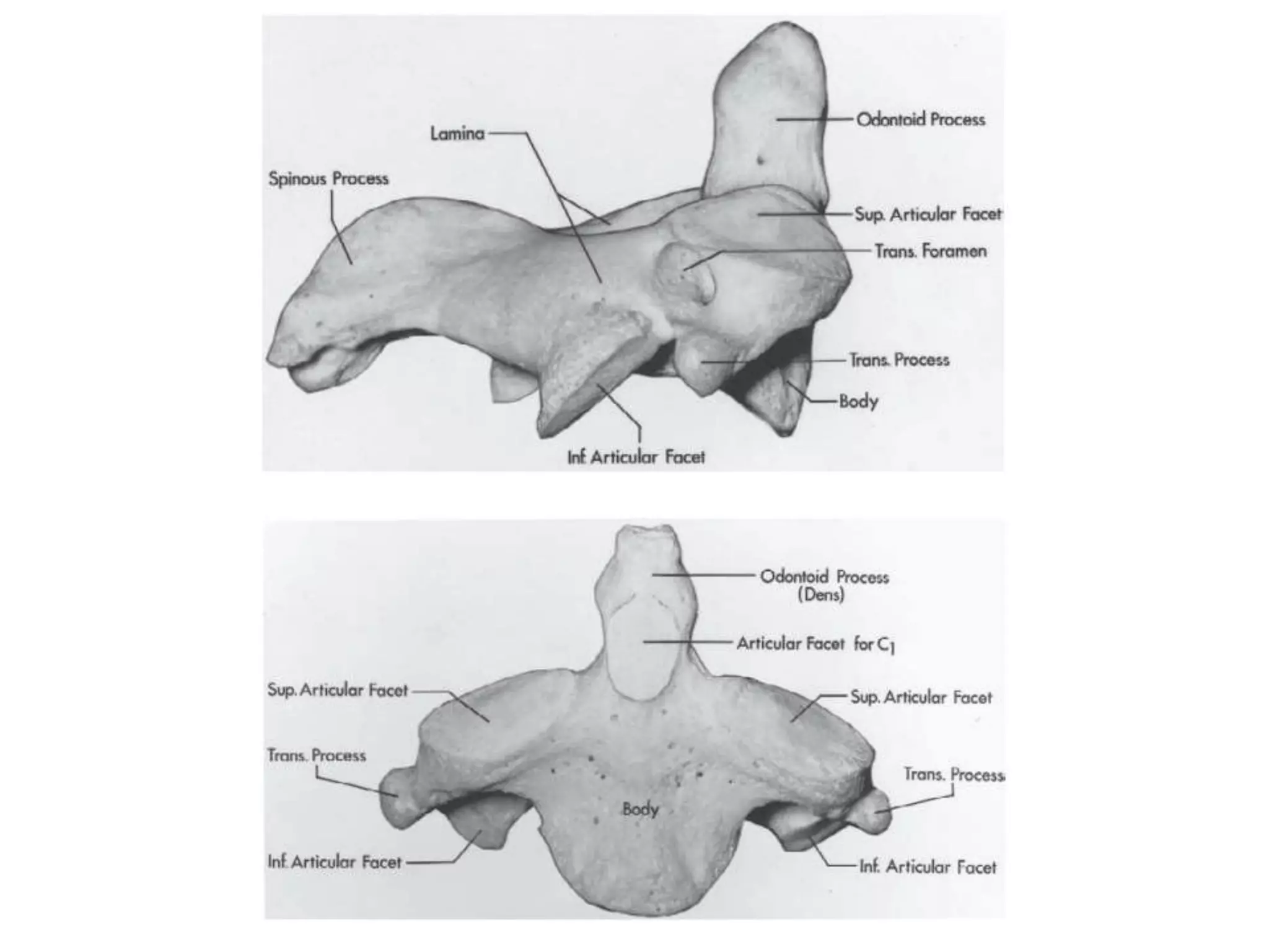 Craniovertebral junction cvj embryology | PPTX