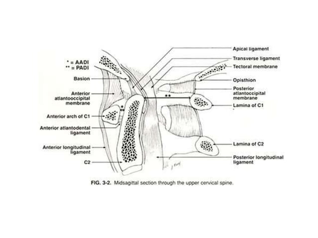Craniovertebral junction cvj embryology | PPTX
