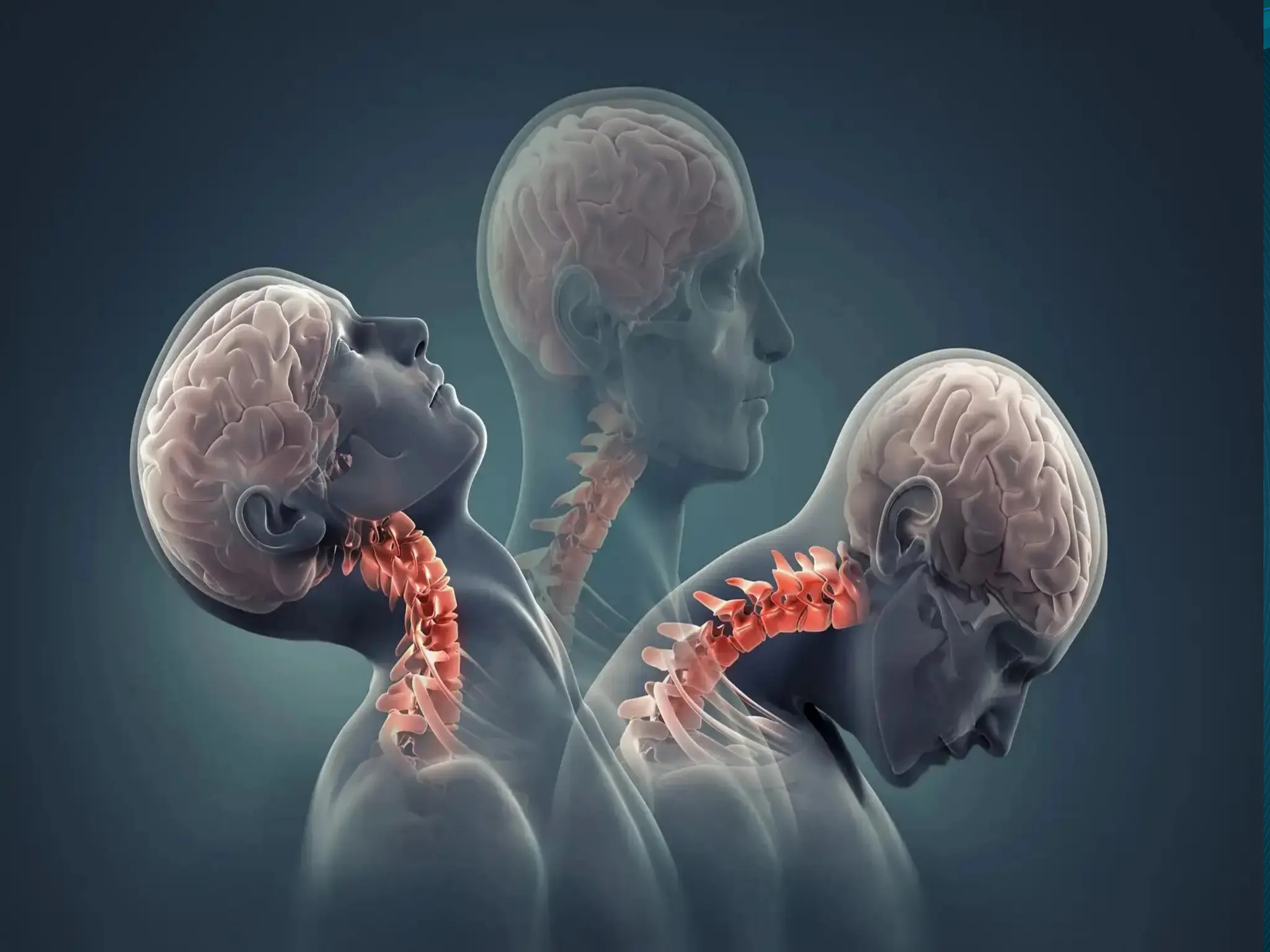 Craniovertebral junction anatomy and imaging radiology PPT.pptx