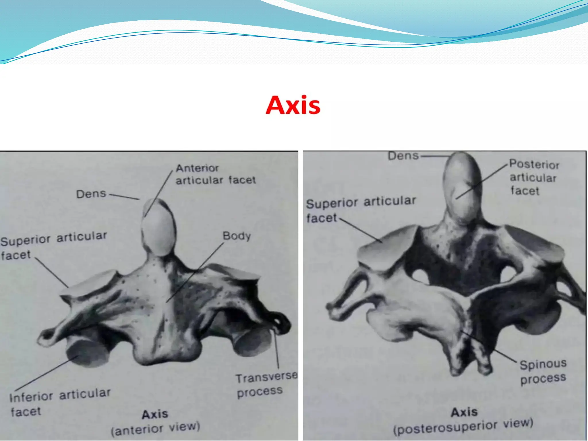 Craniovertebral junction anatomy and imaging radiology PPT.pptx