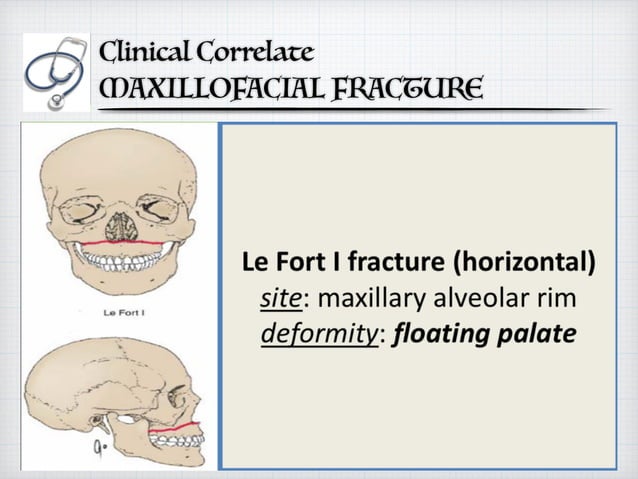 Cranium of the skull copy | PPT