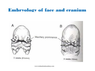 Cranoficial anomalies and craniosynostosis | PPT
