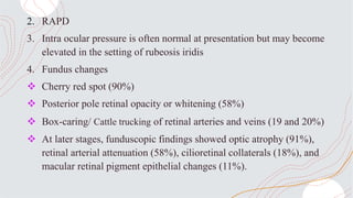 Central retinal artery occlusion | PPTX