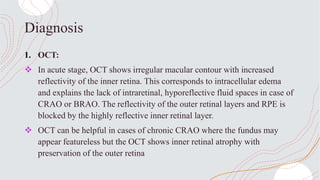 Central retinal artery occlusion | PPTX