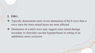 Central retinal artery occlusion | PPTX