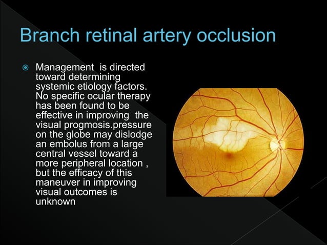CRAO and BRAO | PPTX | Eye and Vision Conditions | Diseases and Conditions