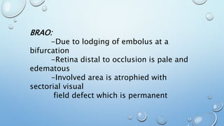 Vascular occlusions of retina | PPTX