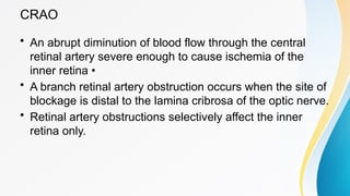 Central retinal artery occlusion , a medical emergency | PPTX