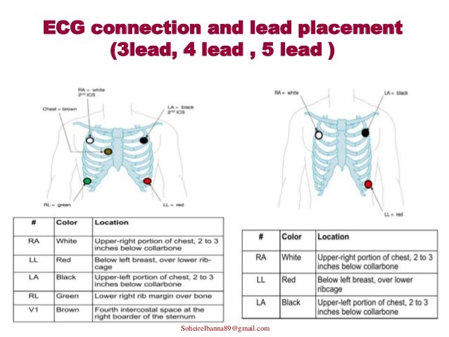 Crash cart part 2 defibrillator https://www.youtu…