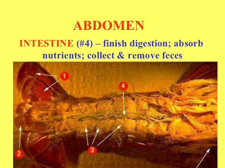 Crayfish Dissection Gonad