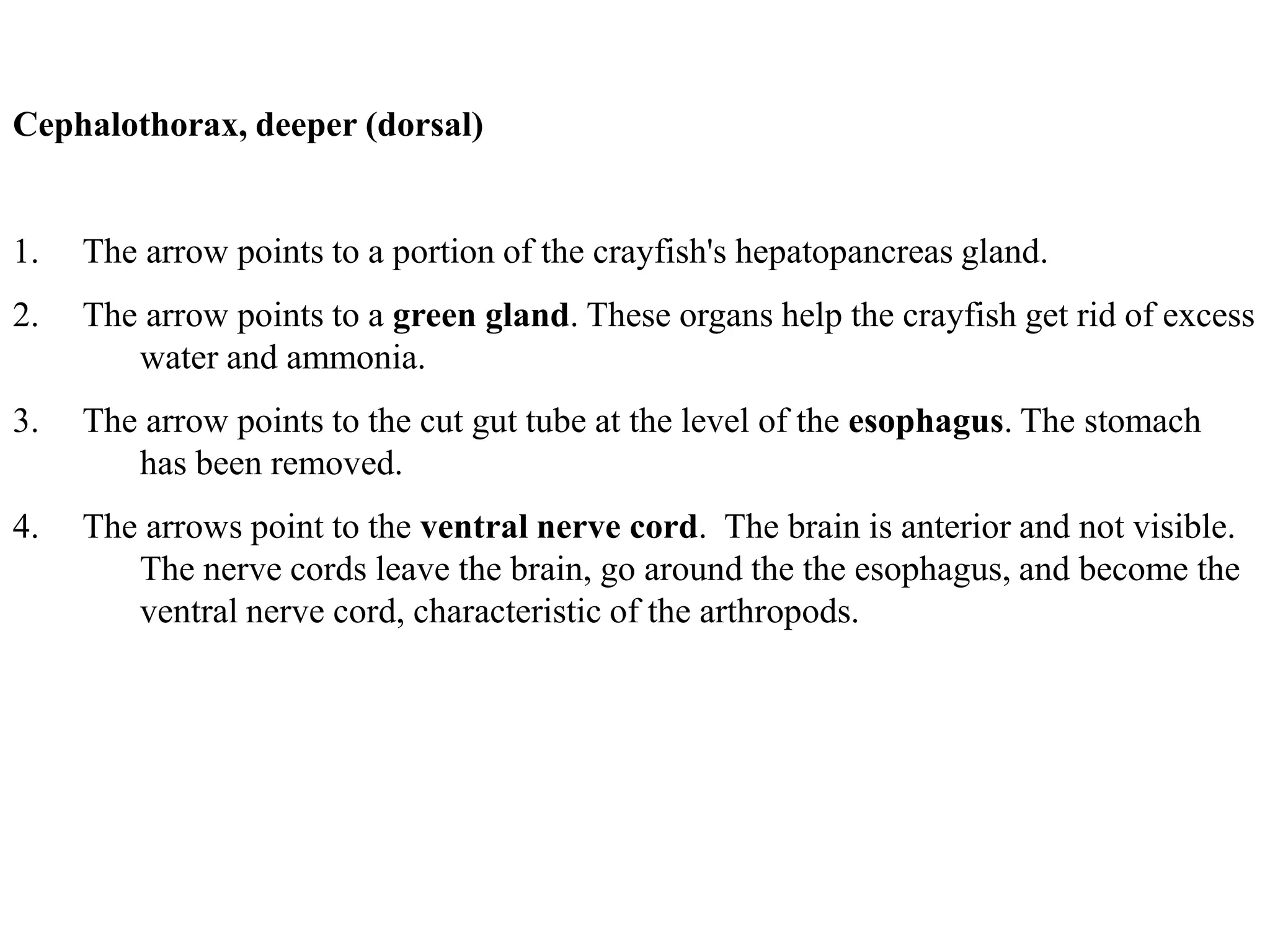 Crayfish dissection diagrams | PPTX