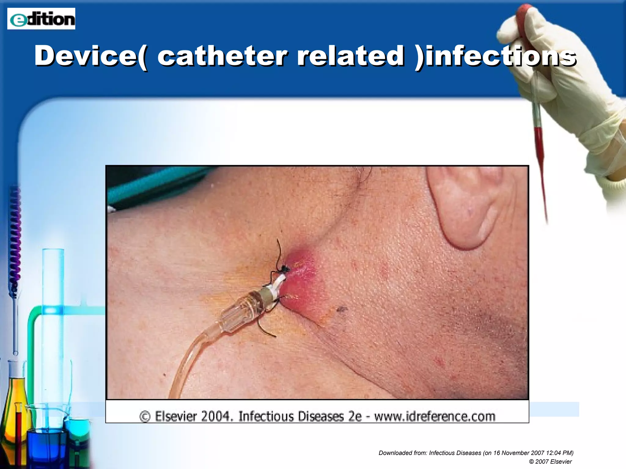 CATHETER RELATED BLOOD STREAM INFECTIONS | PPT