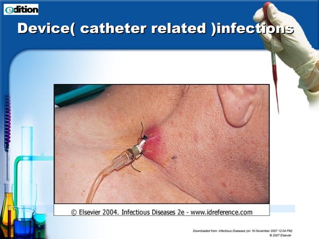 CATHETER RELATED BLOOD STREAM INFECTIONS | PPT | Infectious Diseases ...