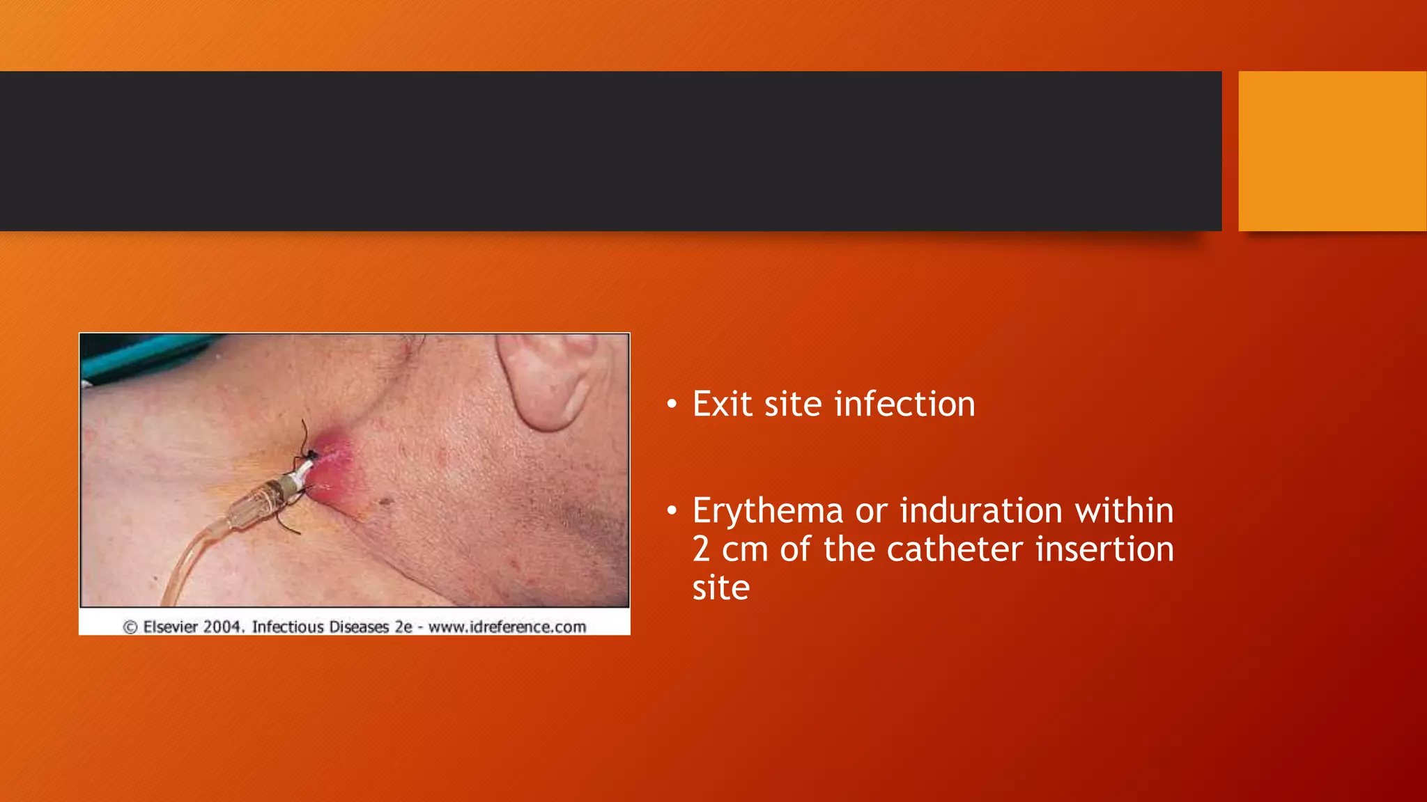 CATHETER RELATED BLOOD STREAM INFECTION | PPTX