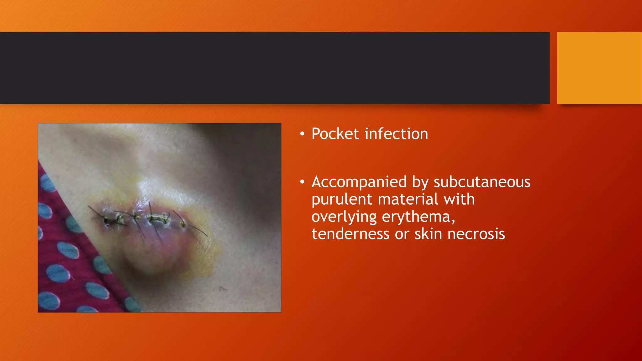 CATHETER RELATED BLOOD STREAM INFECTION | PPTX