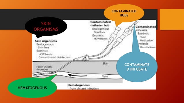 CATHETER RELATED BLOOD STREAM INFECTION | PPTX | Infectious Diseases ...