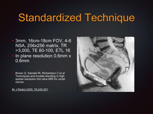 Ca Rectum Imaging | PPTX | Digestive Disorders | Diseases and Conditions