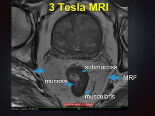 Rectum Anatomy Mri